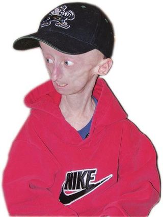 Darrington loses inspirational teen | Arlington Times